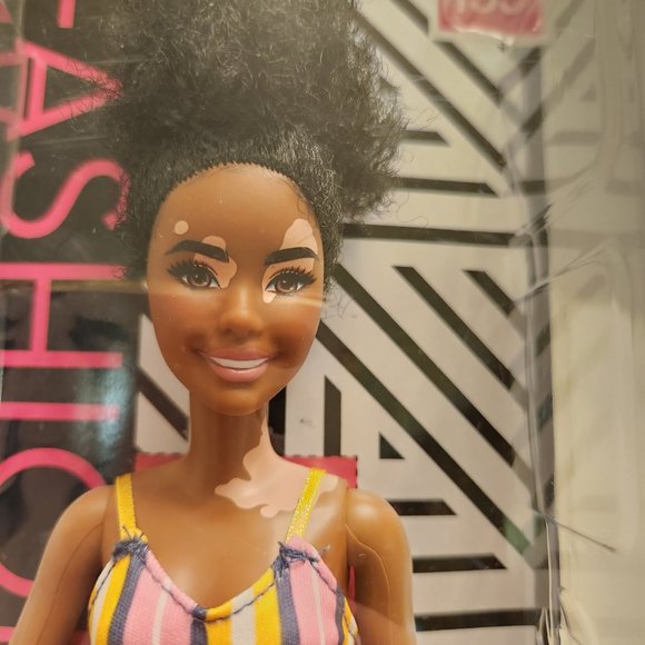 Barbie | Toys | Barbie Fashionista 35 Doll With Vitiligo Curly Hair ...